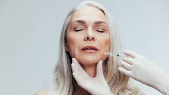 Want a Facelift in Your 50s? Read This First