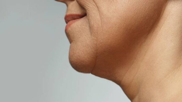 What to Do When Your Neck is Aging Fast