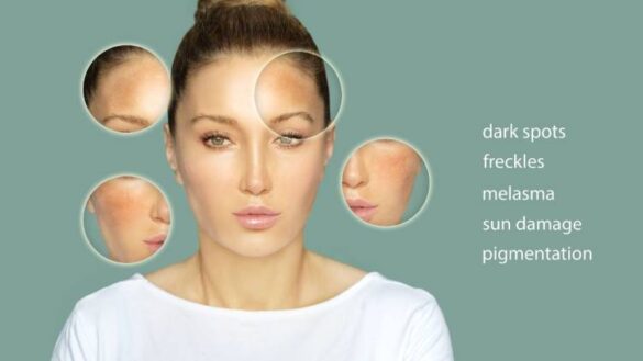 Premature Aging and Sunlight - Photoaging Explained